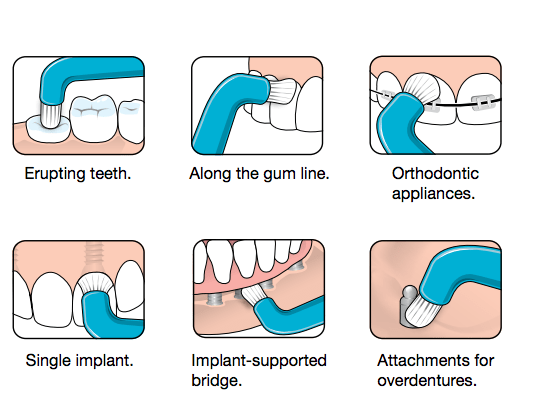 Vieno danties šepetėlis – Dantistai