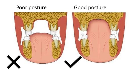 Kvėpavimas per burną. Ką reikia žinoti? – Dantistai